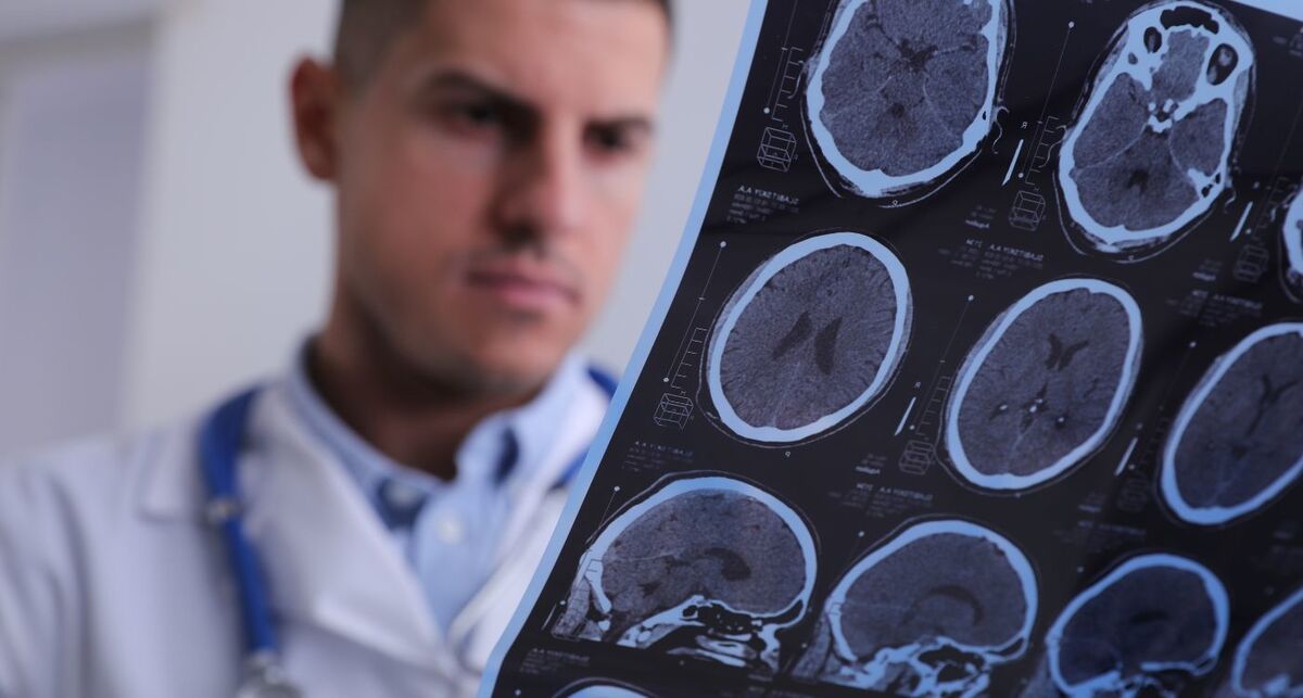 How Long Do Concussions Last? | Coeur d’Alene Concussion Care